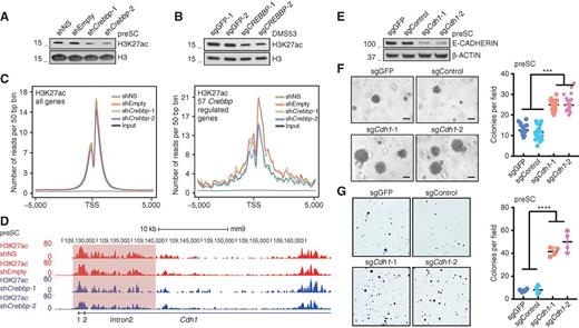 Crebbp Loss Drives Small Cell Lung Cancer and Increases Sensitivity to ...