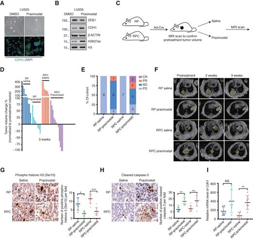 Crebbp Loss Drives Small Cell Lung Cancer and Increases Sensitivity to ...