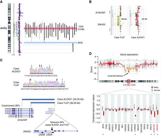 Deletion 6q Drives T-cell Leukemia Progression by Ribosome Modulation ...
