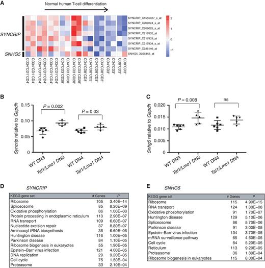 Deletion 6q Drives T-cell Leukemia Progression by Ribosome Modulation ...