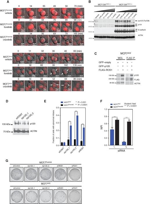 E-Cadherin/ROS1 Inhibitor Synthetic Lethality in Breast Cancer | Cancer ...