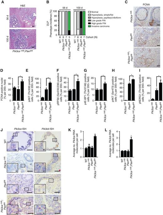 Identification of Pik3ca Mutation as a Genetic Driver of Prostate ...