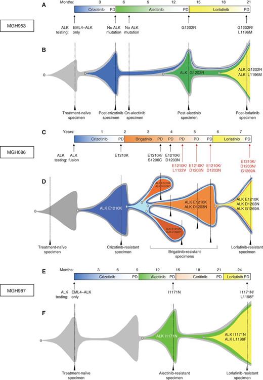 Sequential ALK Inhibitors Can Select for Lorlatinib-Resistant Compound ...