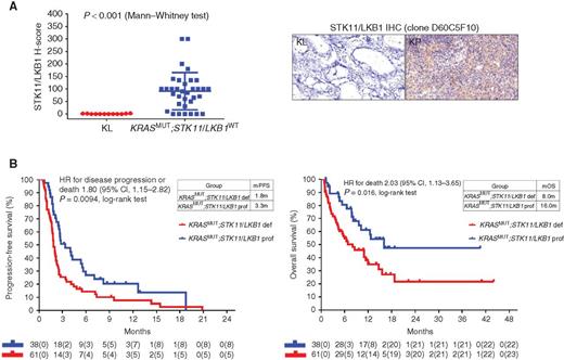 STK11/LKB1 Mutations and PD-1 Inhibitor Resistance in KRAS-Mutant Lung ...