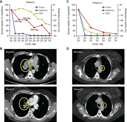 Precision Targeted Therapy with BLU-667 for RET-Driven Cancers | Cancer ...