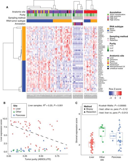 Real-time Genomic Characterization of Advanced Pancreatic Cancer to ...