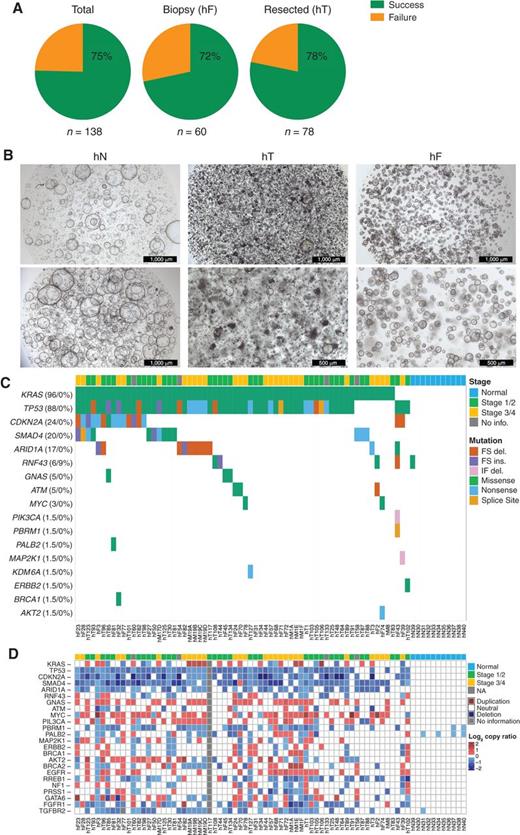 Organoid Profiling Identifies Common Responders to Chemotherapy in ...