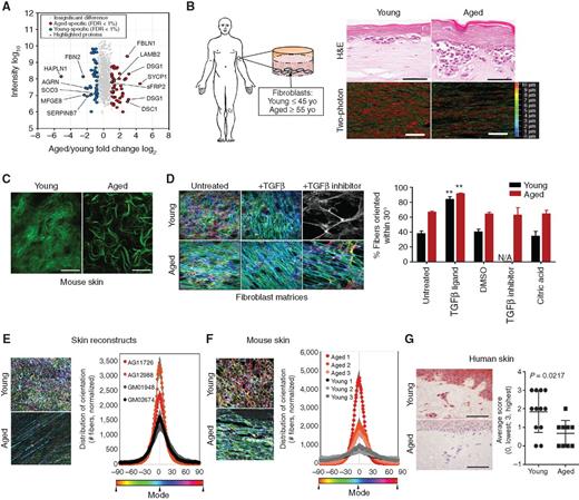 Remodeling of the Collagen Matrix in Aging Skin Promotes Melanoma ...
