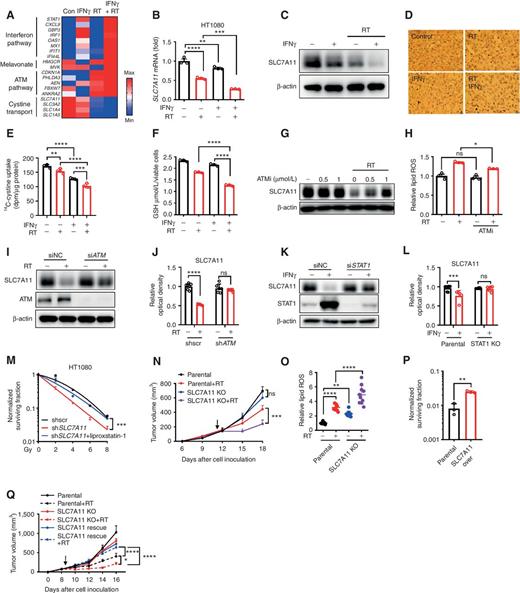 Radiotherapy and Immunotherapy Promote Tumoral Lipid Oxidation and ...
