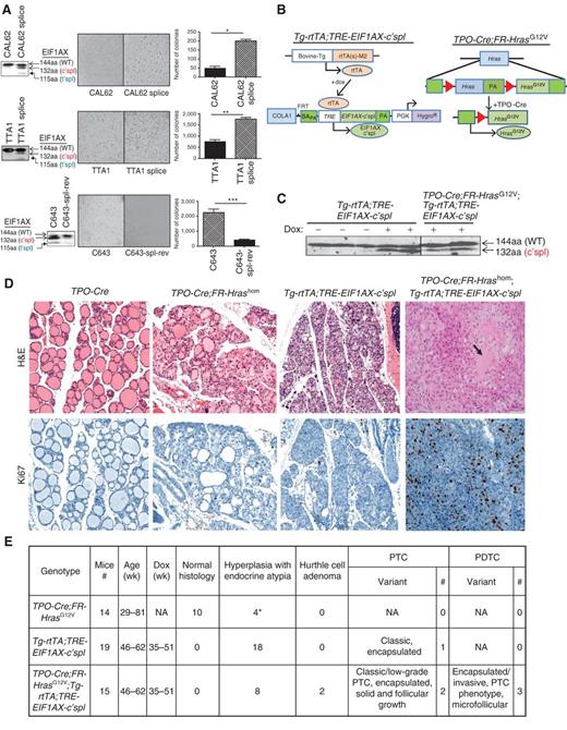 EIF1AX and RAS Mutations Cooperate to Drive Thyroid Tumorigenesis ...