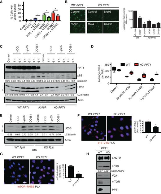 PPT1 Promotes Tumor Growth and Is the Molecular Target of Chloroquine ...