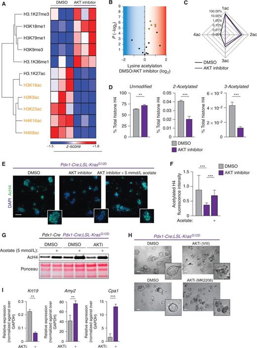 Acetyl-CoA Metabolism Supports Multistep Pancreatic Tumorigenesis ...