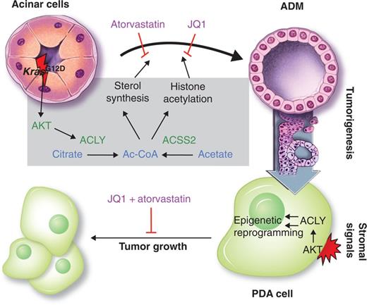 Metabolism Drives Carcinogenesis and Maintenance of Pancreatic Tumors ...