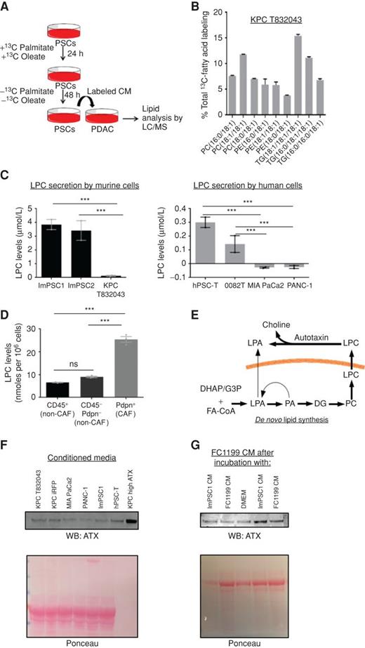 A Stromal Lysolipid–Autotaxin Signaling Axis Promotes Pancreatic Tumor ...