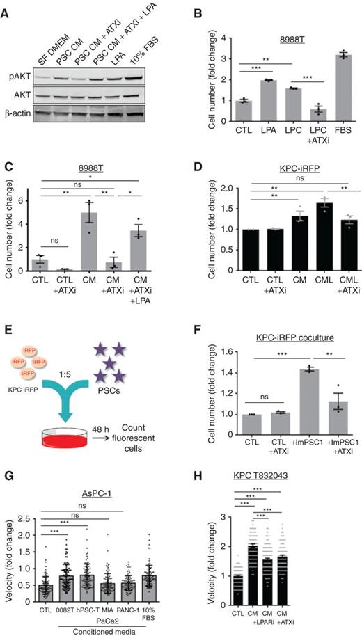 A Stromal Lysolipid–Autotaxin Signaling Axis Promotes Pancreatic Tumor ...