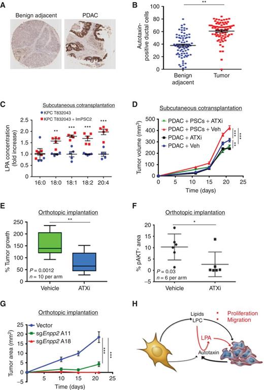 A Stromal Lysolipid–Autotaxin Signaling Axis Promotes Pancreatic Tumor ...