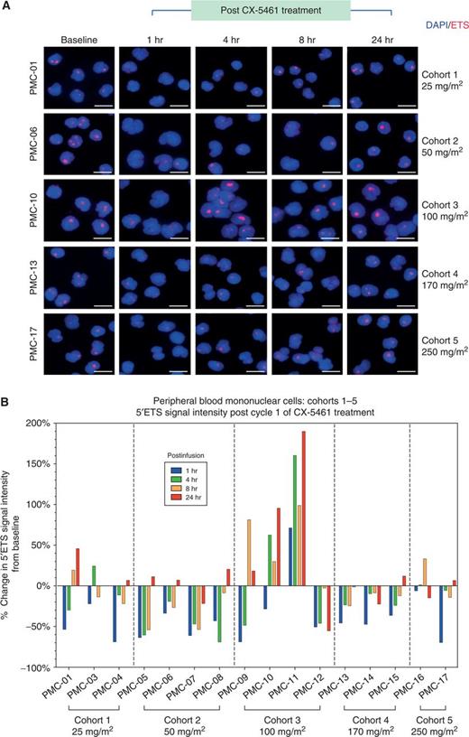 First-in-Human RNA Polymerase I Transcription Inhibitor CX-5461 in ...