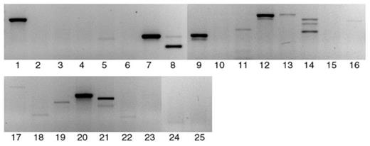 The cancer/testis genes: Review, standardization, and commentary ...