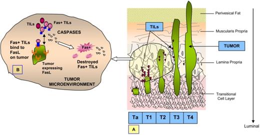 Focus on TILs: Prognostic significance of tumor infiltrating ...