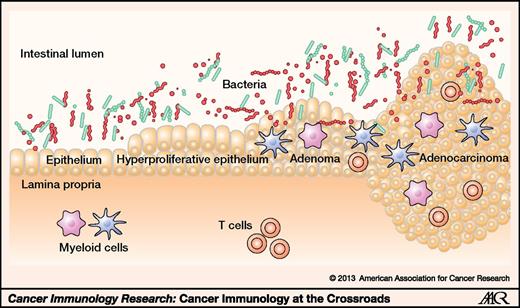 Microbes and Inflammation in Colorectal Cancer | Cancer Immunology ...