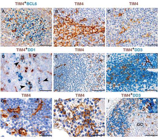 A Population of TIM4+FOLR2+ Macrophages Localized in Tertiary Lymphoid ...