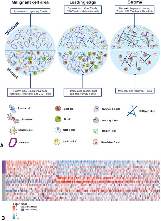 The Tumor Microenvironment of Clear-Cell Ovarian Cancer | Cancer ...