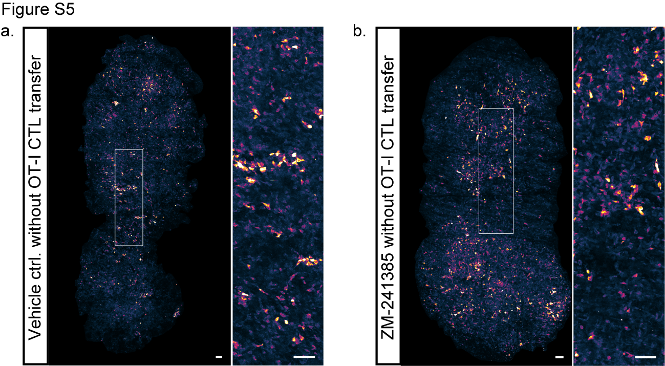 Adenosine A2a Receptor Antagonism Restores Additive Cytotoxicity by ...