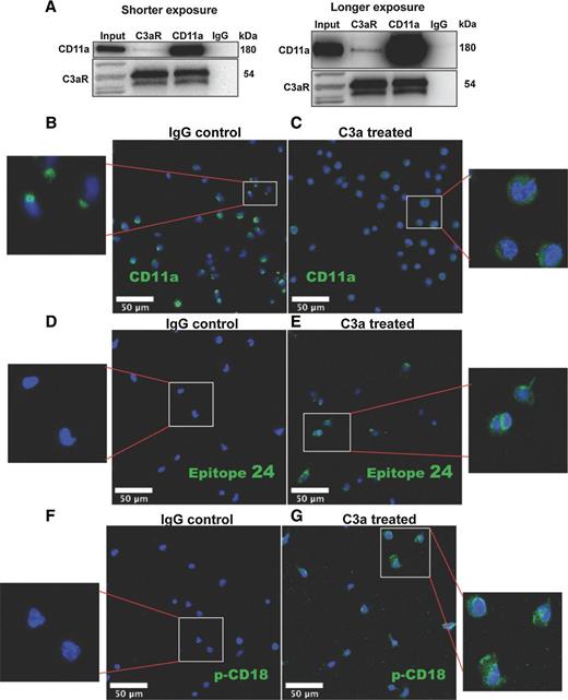 C3aR Signaling Inhibits NK-cell Infiltration into the Tumor ...