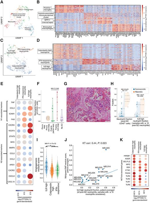 Microenvironmental Landscape of Human Melanoma Brain Metastases in ...