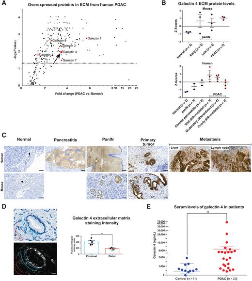 Extracellular Galectin 4 Drives Immune Evasion and Promotes T-cell ...