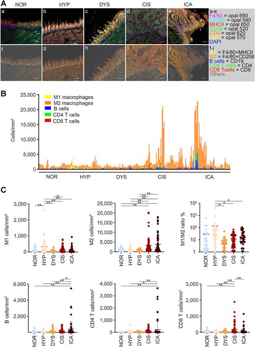 Genomic and Transcriptomic Landscape of an Oral Squamous Cell Carcinoma ...