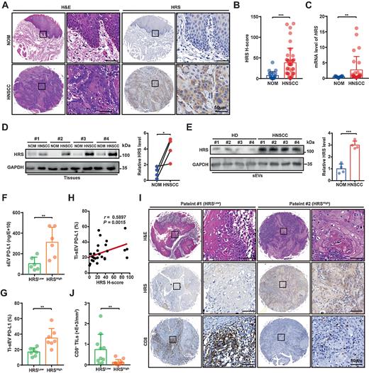 Hrs Regulates Small Extracellular Vesicle Pd L1 Secretion And Is