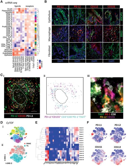 Tissue-Resident Memory T Cells in Pancreatic Ductal Adenocarcinoma ...