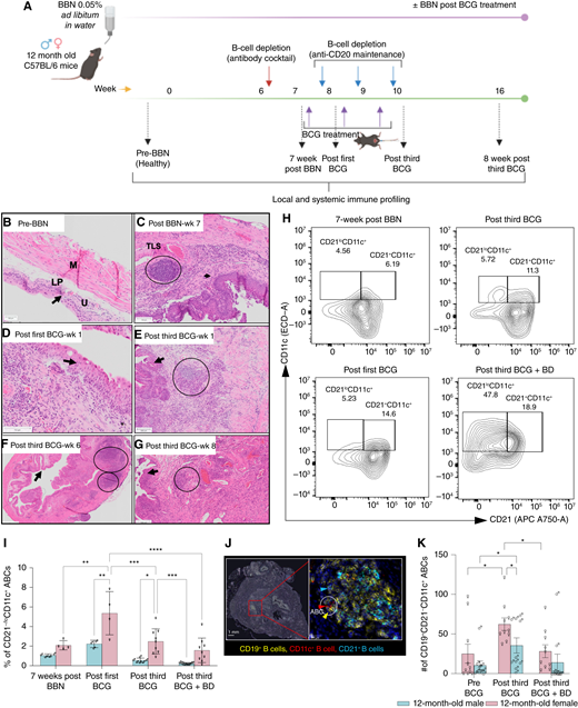 Atypical B Cells Promote Cancer Progression and Poor Response to ...