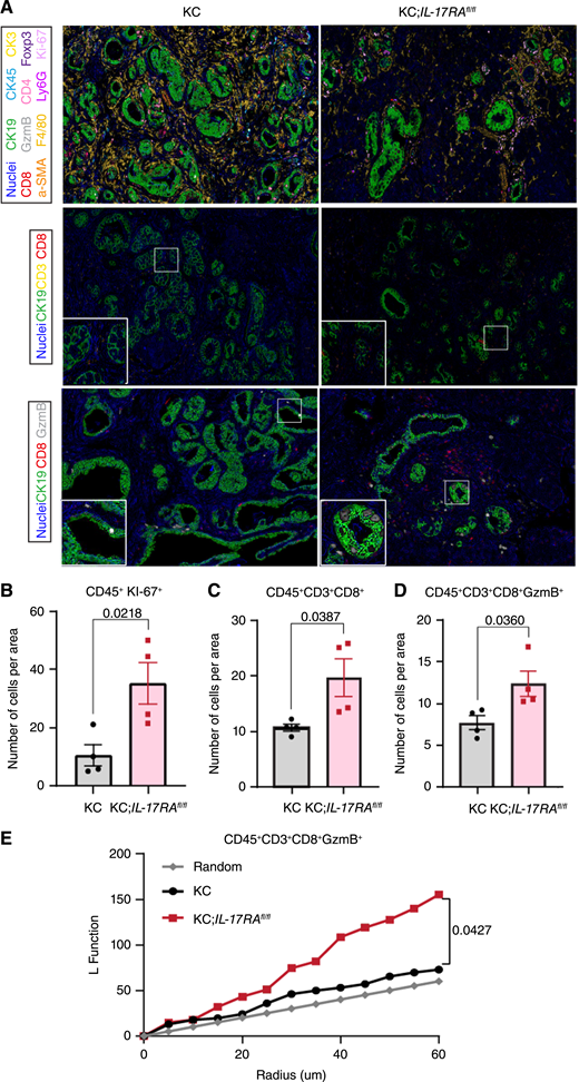 Pancreatic Epithelial IL17/IL17RA Signaling Drives B7-H4 Expression to ...