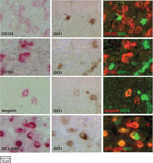 Extensive Profiling of the Expression of the Indoleamine 2,3 ...