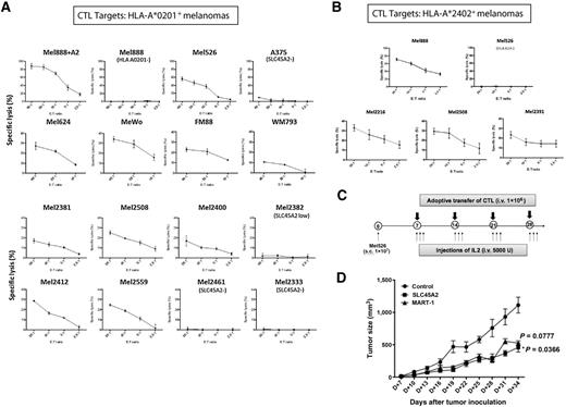 SLC45A2: A Melanoma Antigen with High Tumor Selectivity and Reduced ...