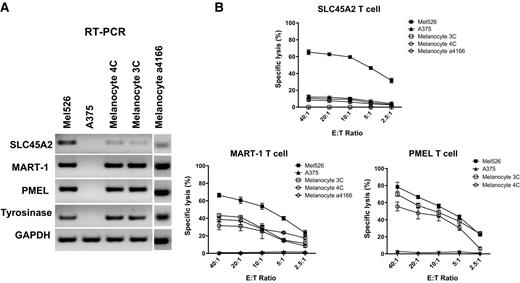 SLC45A2: A Melanoma Antigen with High Tumor Selectivity and Reduced ...