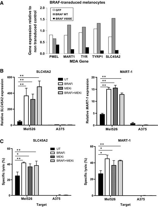 SLC45A2: A Melanoma Antigen with High Tumor Selectivity and Reduced ...