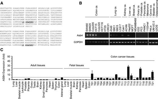 The Antigen ASB4 on Cancer Stem Cells Serves as a Target for CTL ...