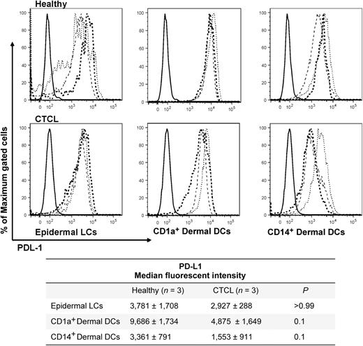 Primary T Cells from Cutaneous T-cell Lymphoma Skin Explants Display an ...