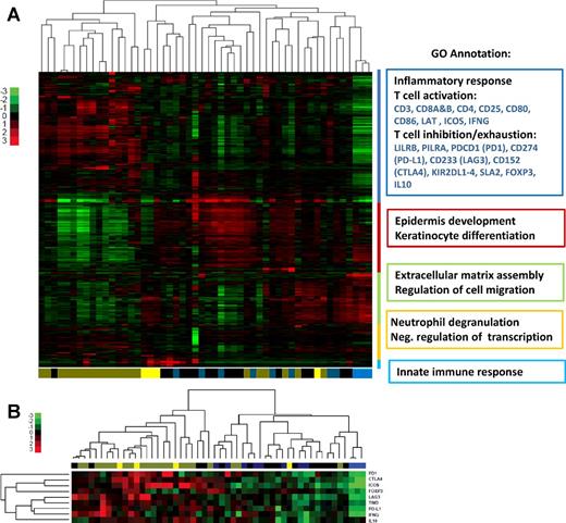 Primary T Cells from Cutaneous T-cell Lymphoma Skin Explants Display an ...
