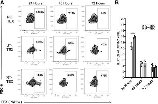Exosomes Shuttle TREX1-Sensitive IFN-Stimulatory dsDNA from Irradiated ...