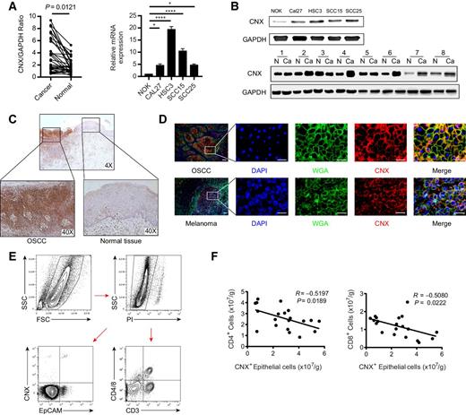 Calnexin Impairs the Antitumor Immunity of CD4+ and CD8+ T Cells ...