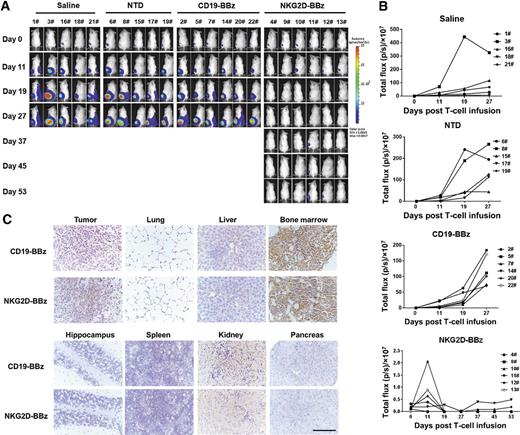 Eradication of Hepatocellular Carcinoma by NKG2D-Based CAR-T Cells ...