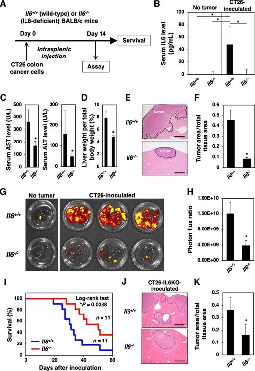 IL6 Modulates the Immune Status of the Tumor Microenvironment to ...