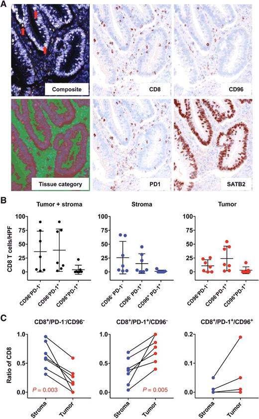 CD96 Is an Immune Checkpoint That Regulates CD8+ T-cell Antitumor ...