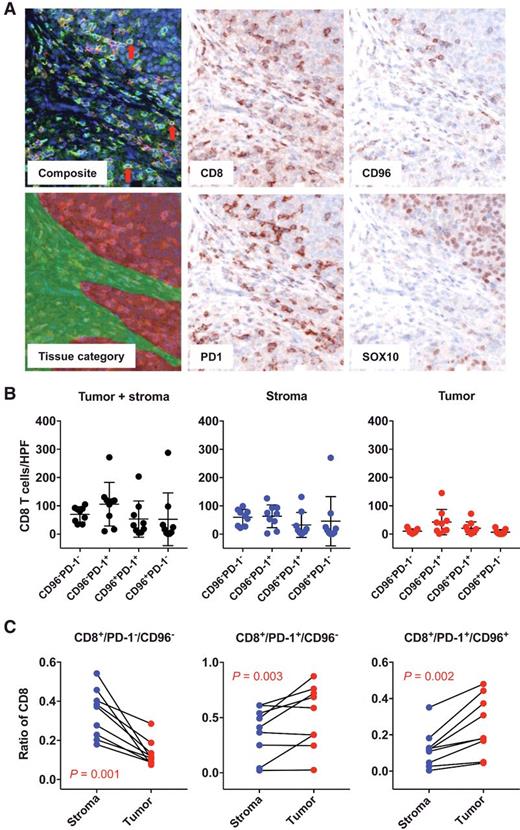CD96 Is an Immune Checkpoint That Regulates CD8+ T-cell Antitumor ...