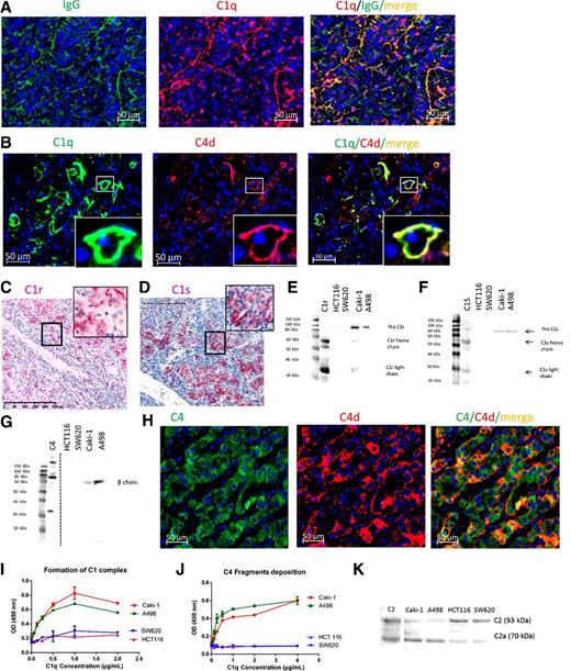 Tumor Cells Hijack Macrophage-Produced Complement C1q to Promote Tumor ...