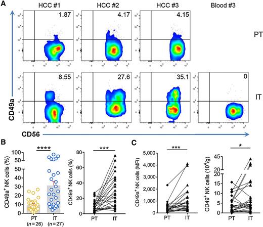 Accumulation of Tumor-Infiltrating CD49a+ NK Cells Correlates with Poor ...